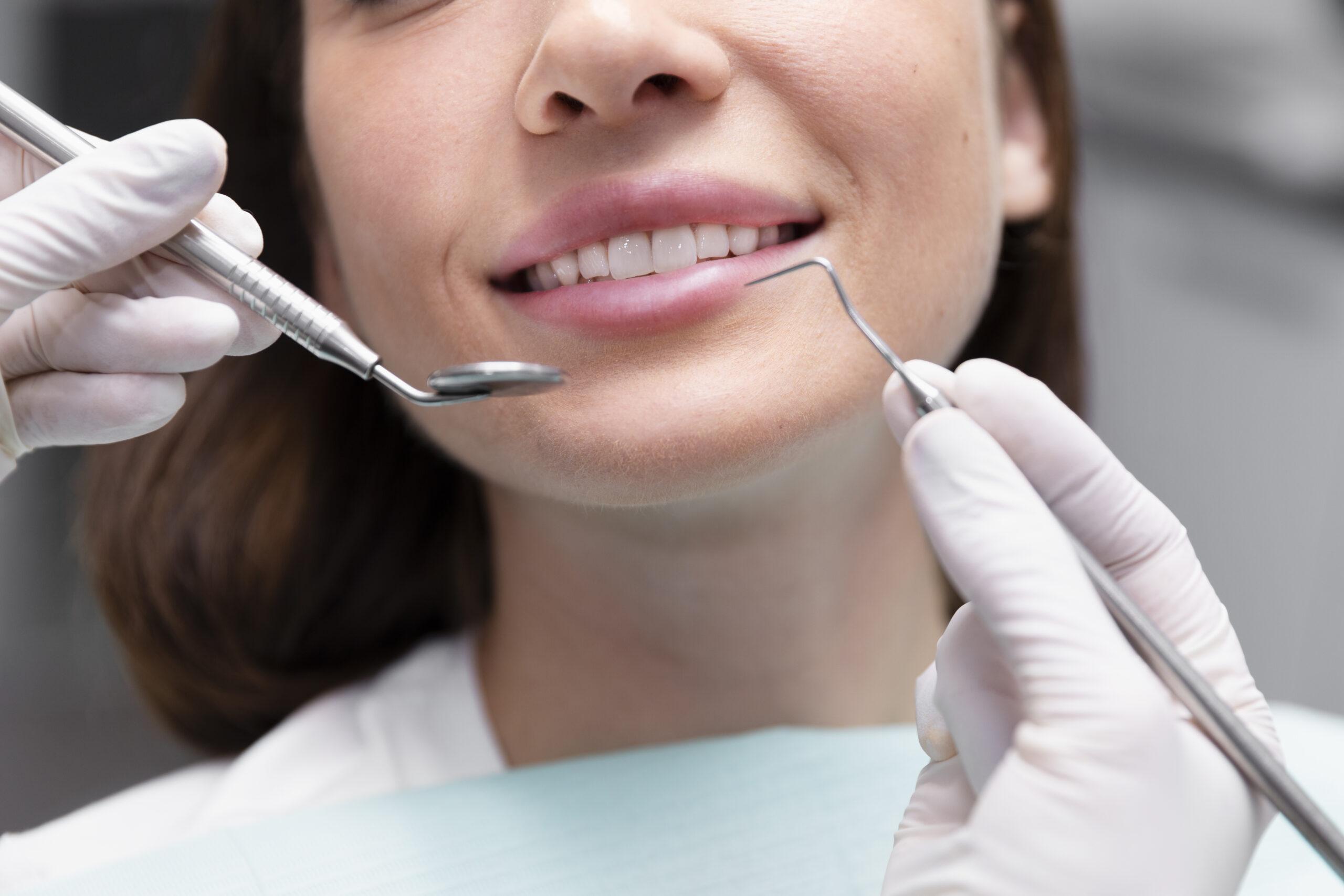 วีเนียร์คอมโพสิต – Dental Arm